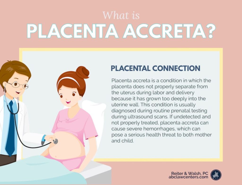 Placenta Accreta | ABC Law Centers: Birth Injury Lawyers